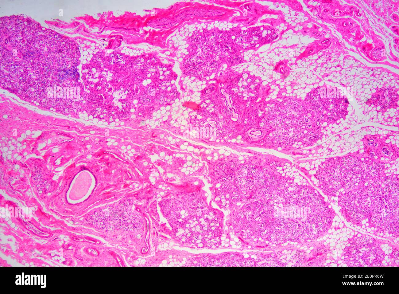 Umbilical Cord Blood High Resolution Stock Photography and Images - Alamy