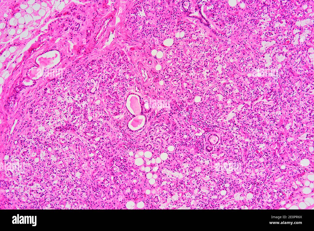 Umbilical hi-res stock photography and images - Alamy