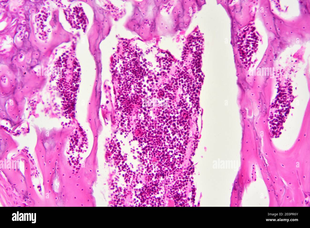 Photomicrograph of bone marrow tissue hi-res stock photography and ...