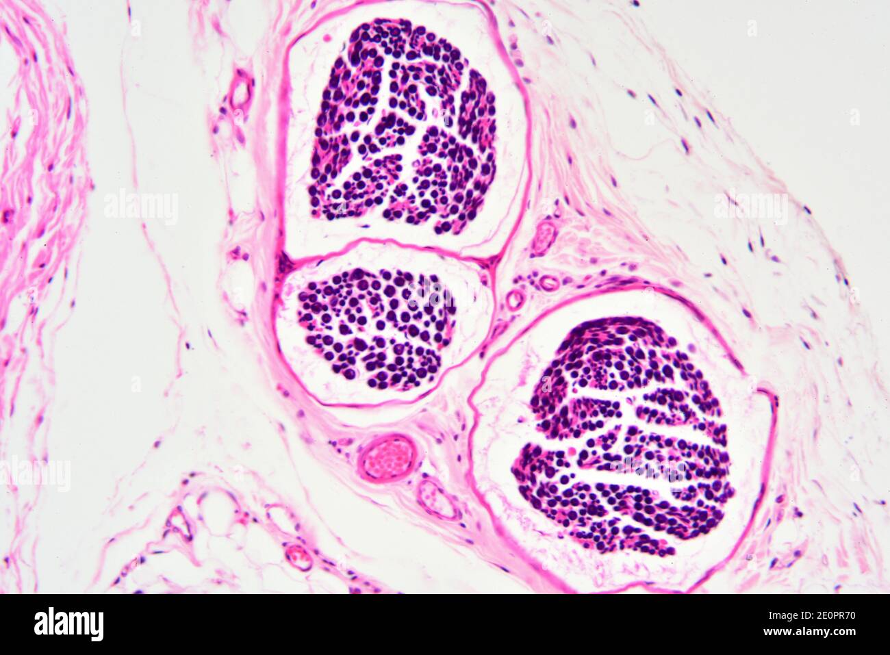 Human nerve system hi-res stock photography and images - Alamy