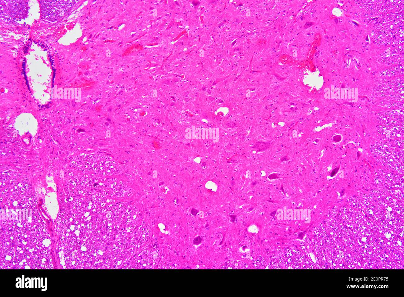 Spinal cord section micrograph hi-res stock photography and images - Alamy