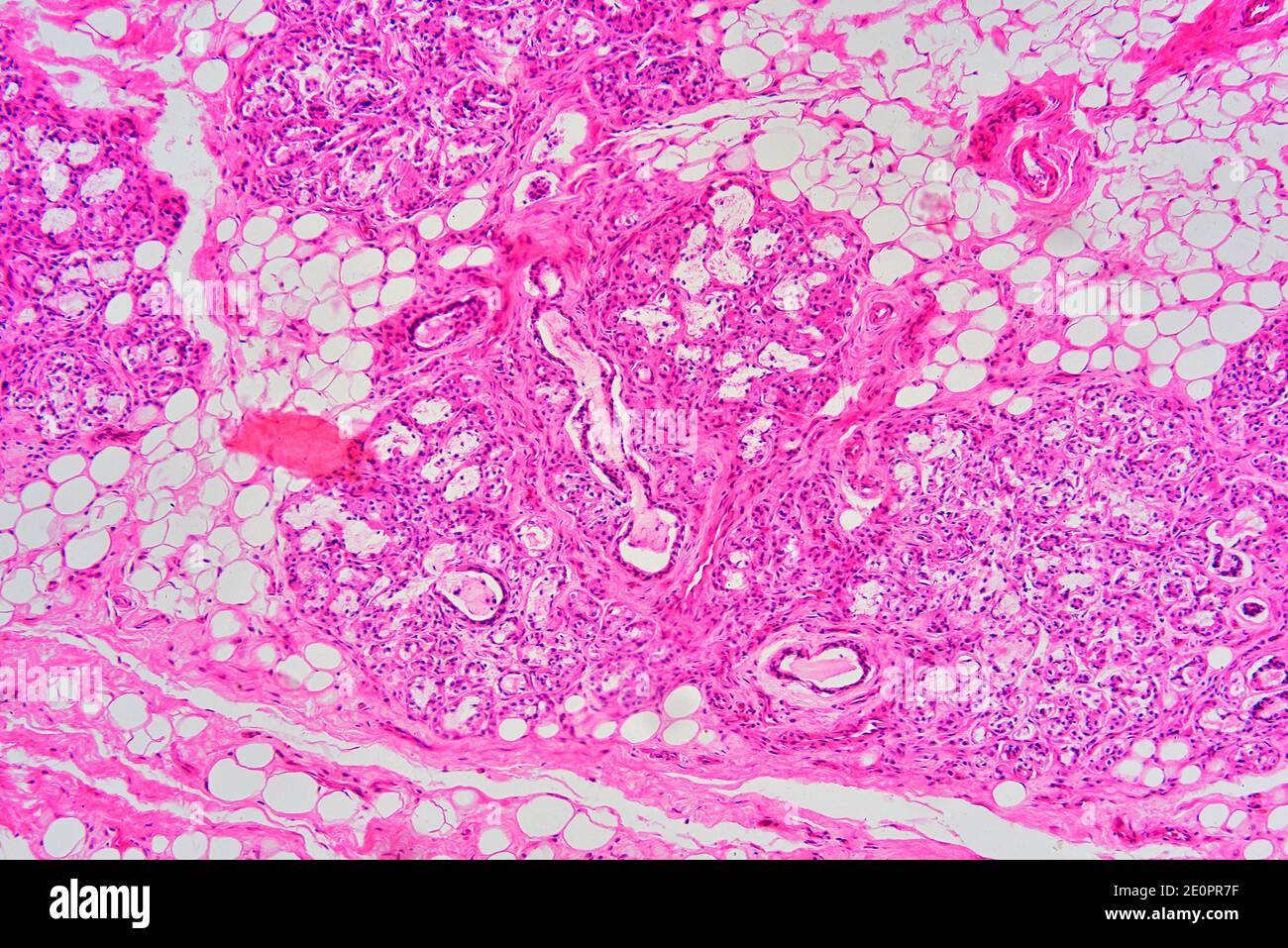 Umbilical Cord Blood High Resolution Stock Photography and Images - Alamy