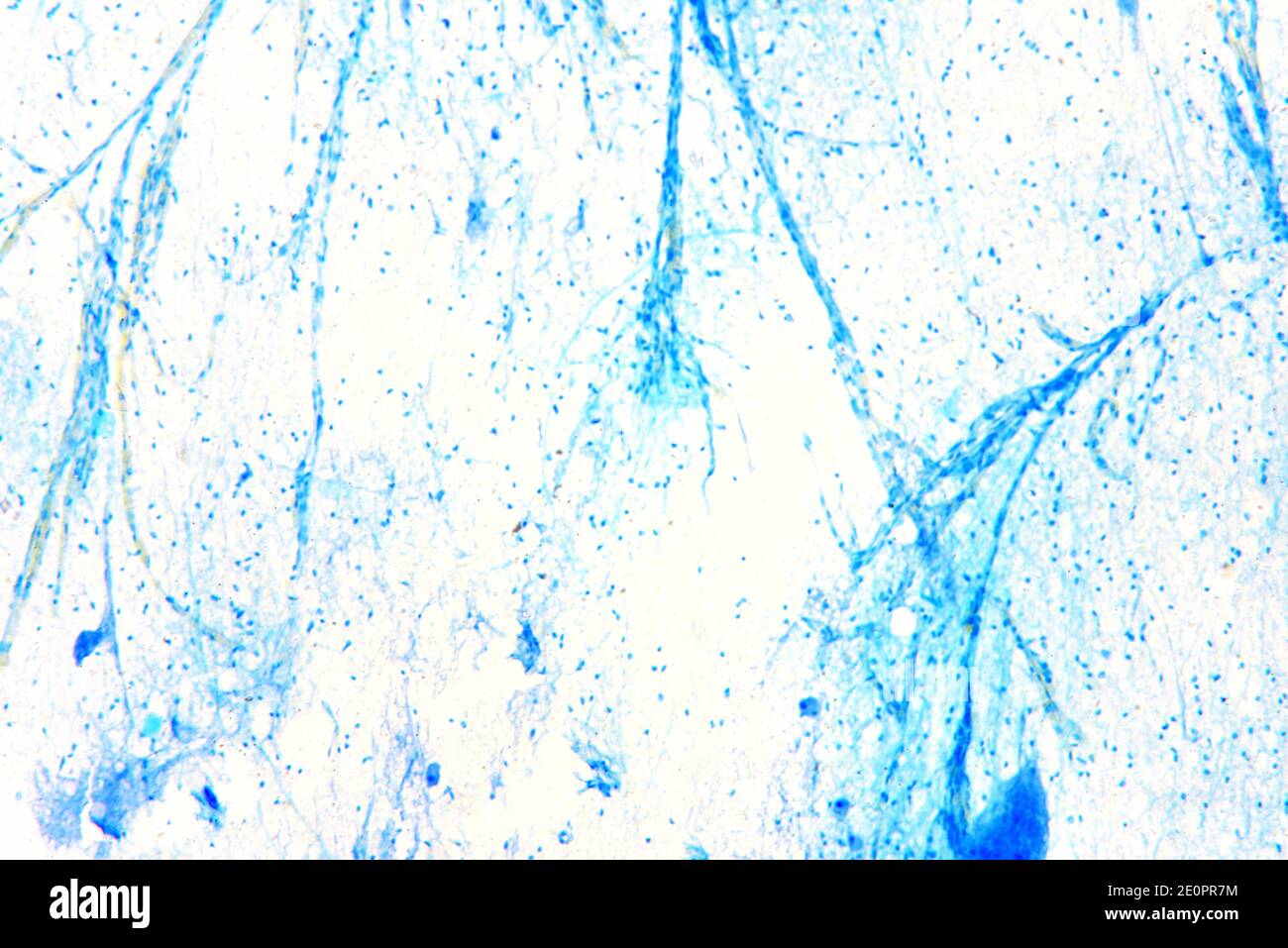 Motor neurons micrograph hi-res stock photography and images - Alamy