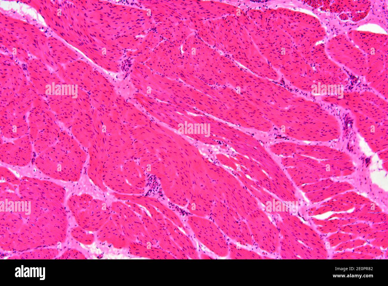 Human striated or skeletal muscle with connetive tissue. X75 at 10 cm ...