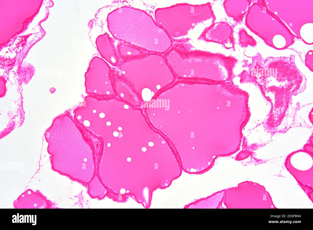 Thyroid follicular cells hi-res stock photography and images - Alamy