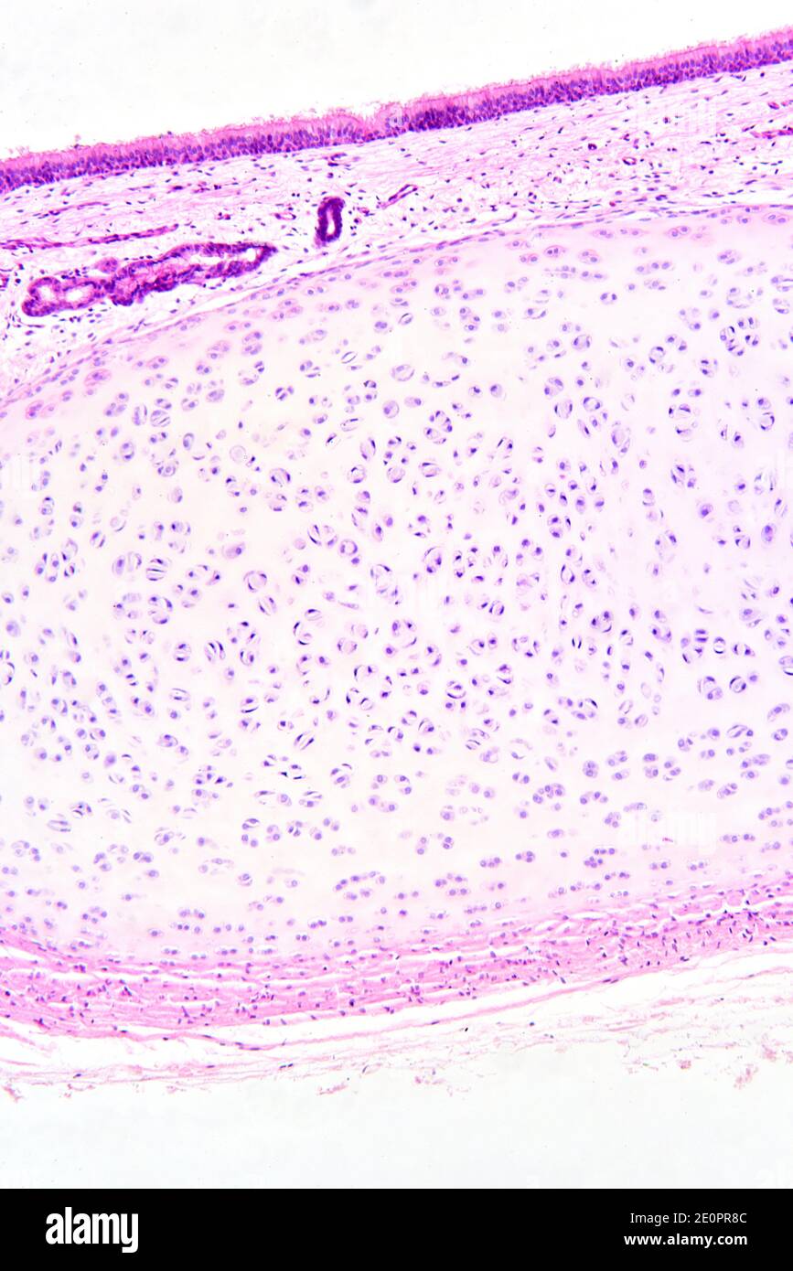 Epiglottis hi-res stock photography and images - Alamy