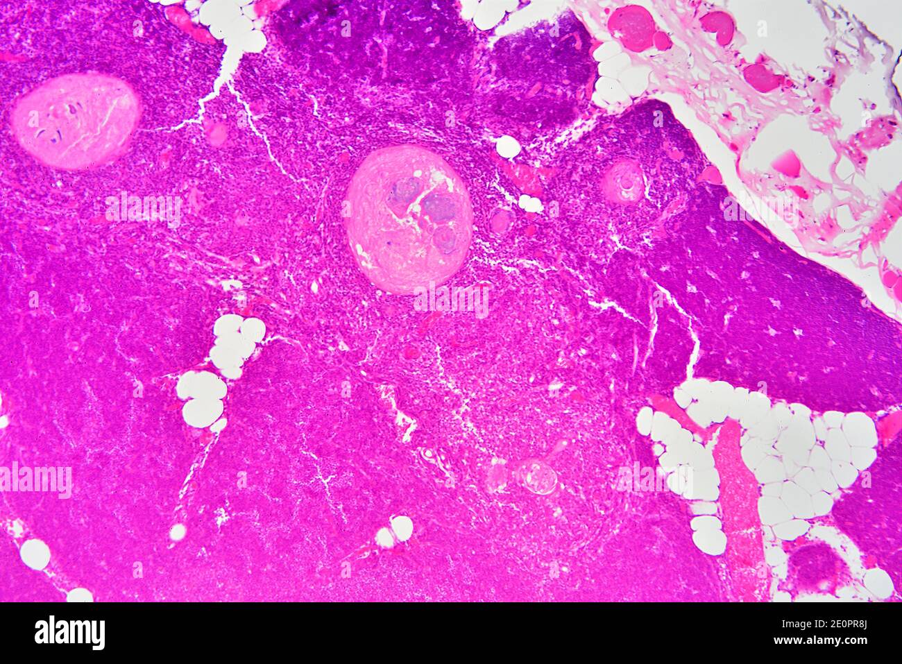 Ruffini Corpuscles Histology