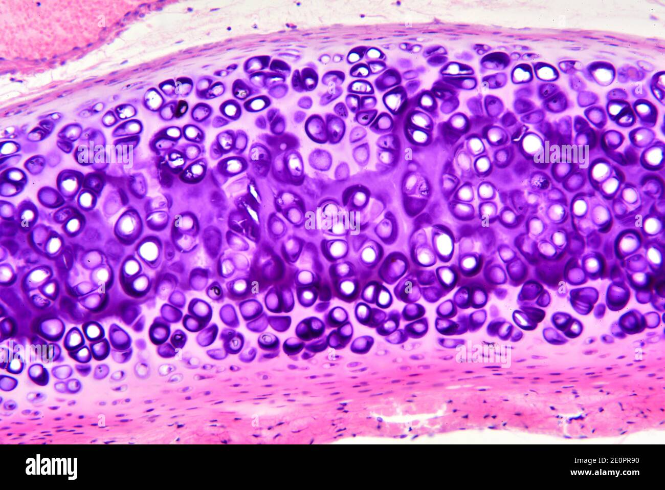 Light micrograph hyaline cartilage hi-res stock photography and images ...