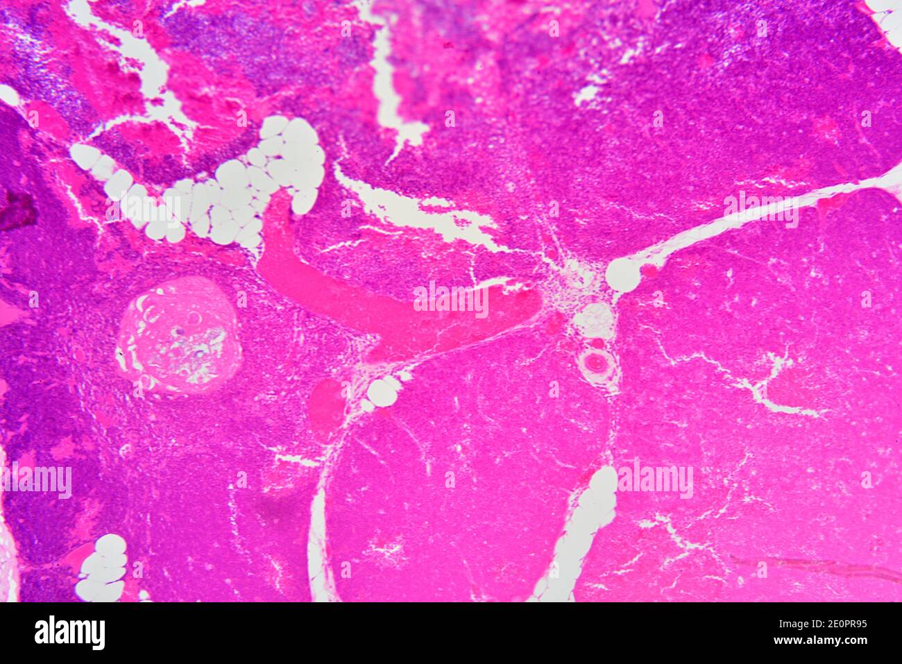 Hassall High Resolution Stock Photography and Images - Alamy