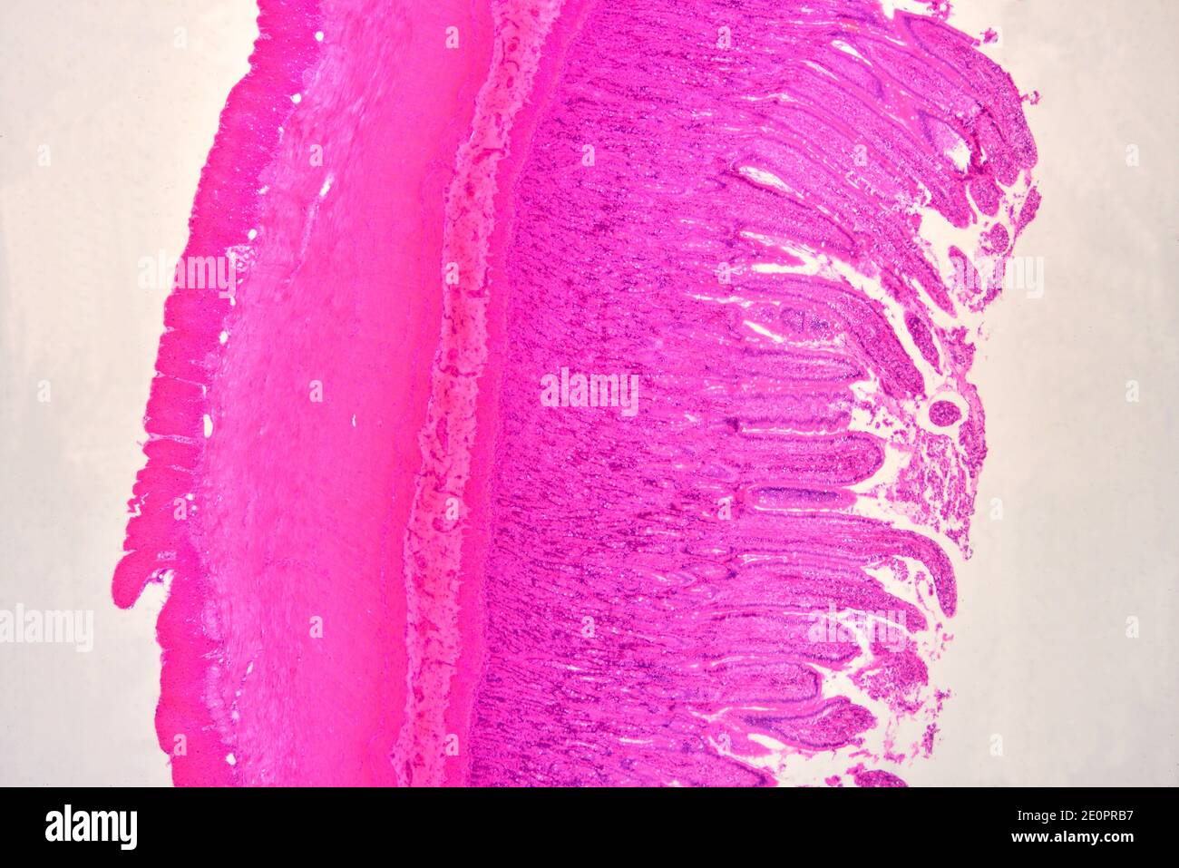 Mucosa wall hi-res stock photography and images - Alamy