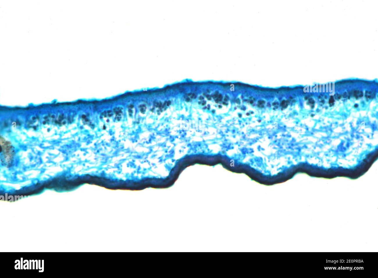 Lichen Cross Section
