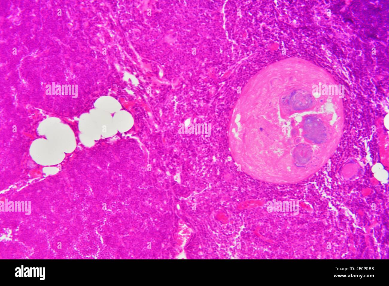 Hassall hi-res stock photography and images - Alamy