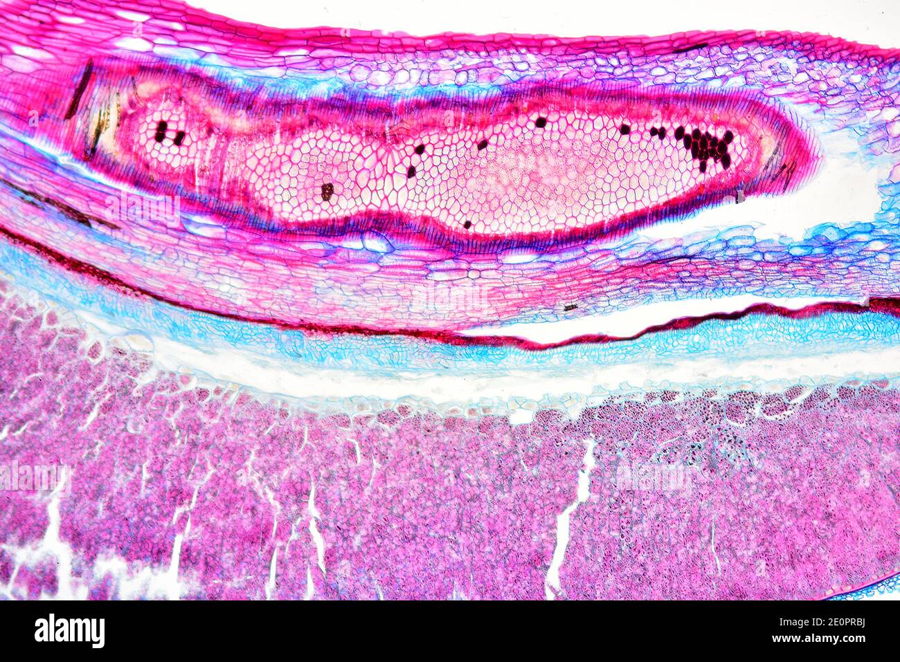 Endosperm hi-res stock photography and images - Alamy