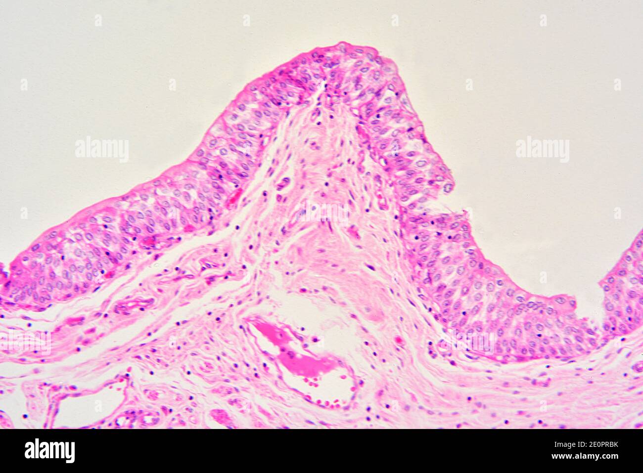 Ureter hi-res stock photography and images - Alamy