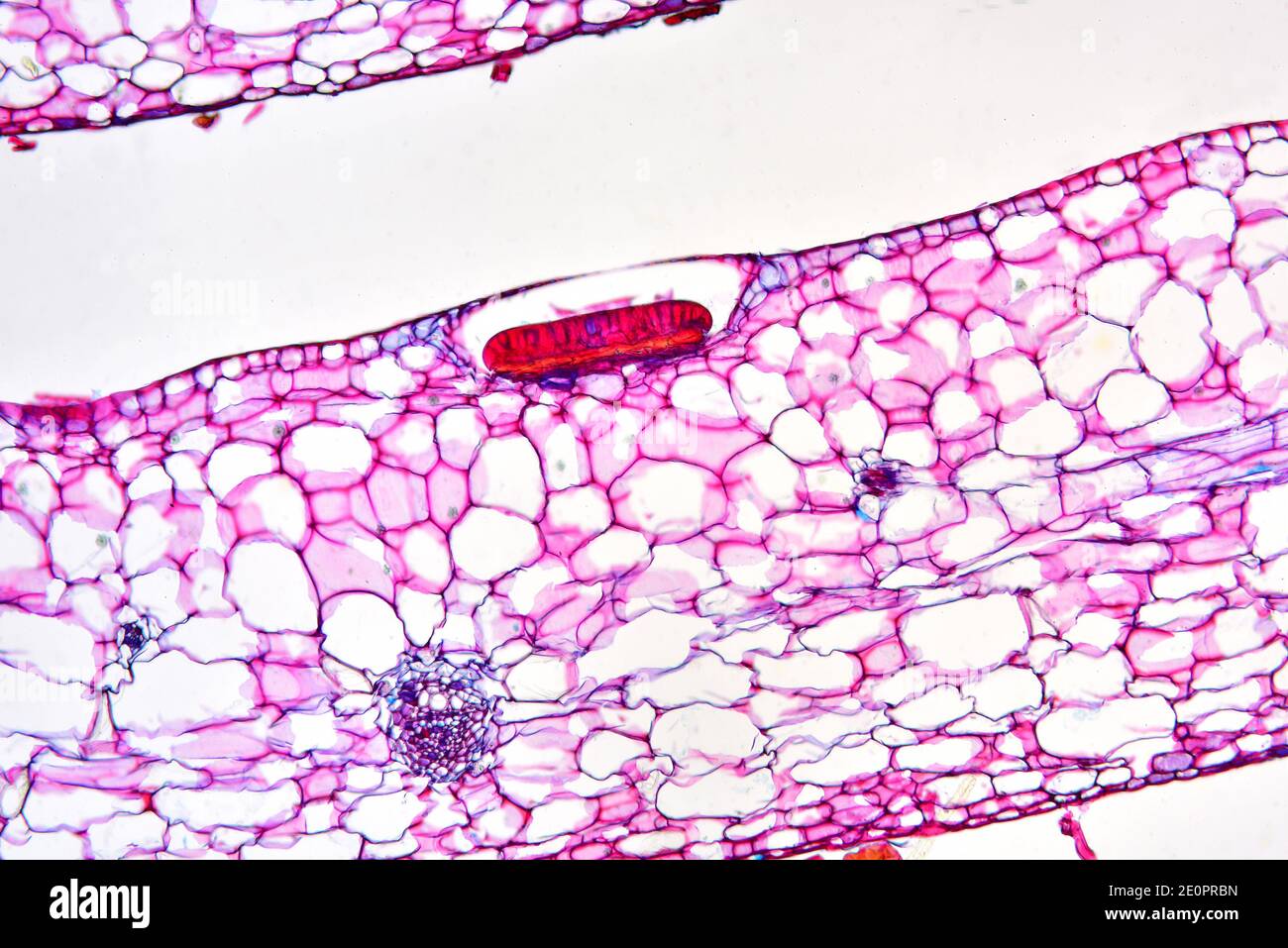 Pitcher gland of Nepenthes sp. , carnivorous plant. X100 at 10 cm wide ...