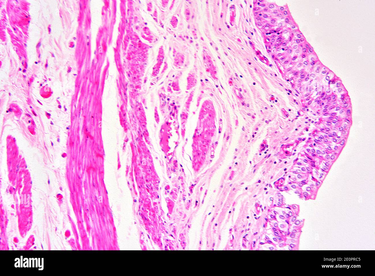 Transitional epithelium hi-res stock photography and images - Alamy