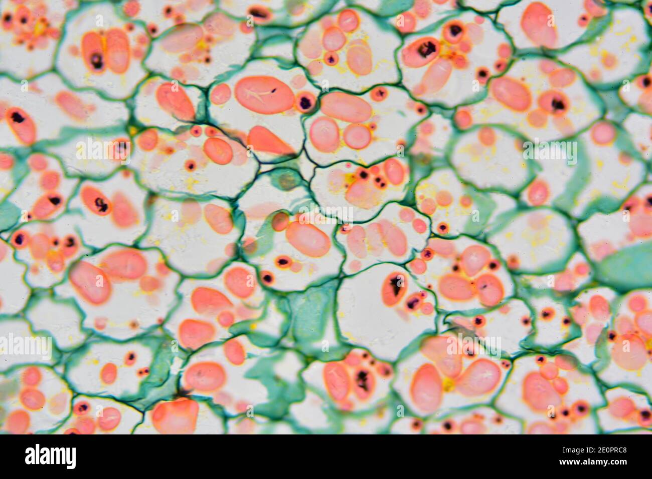 Leucoplast hi-res stock photography and images - Alamy