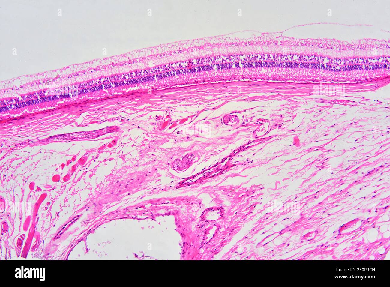 Choroid hi-res stock photography and images - Alamy