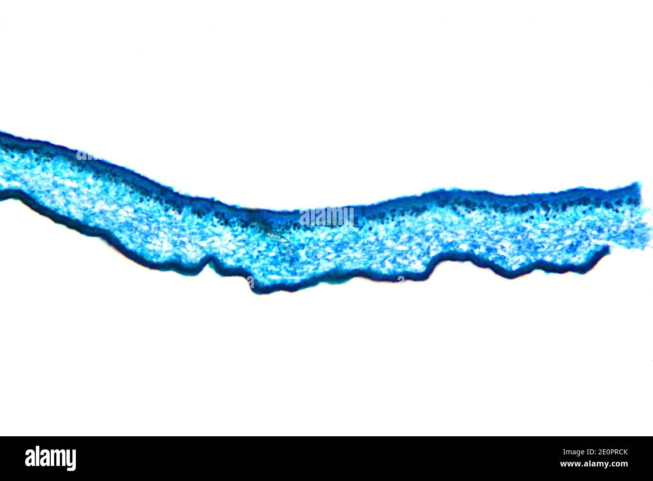 Foliose Lichen Cross Section