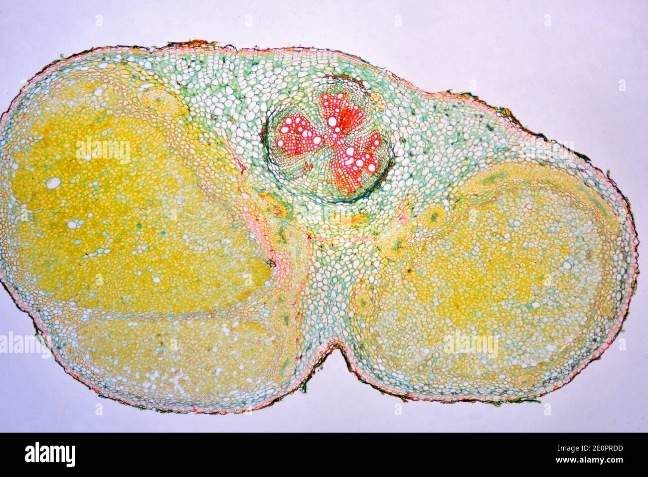Root nodules hi-res stock photography and images - Alamy
