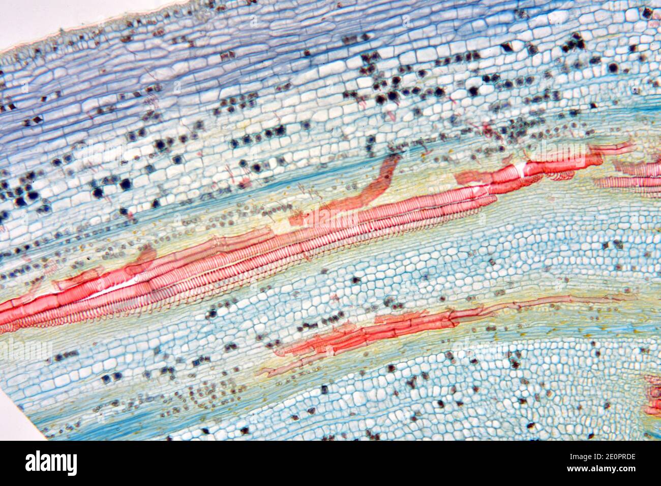 Phloem longitudinal section hi-res stock photography and images - Alamy