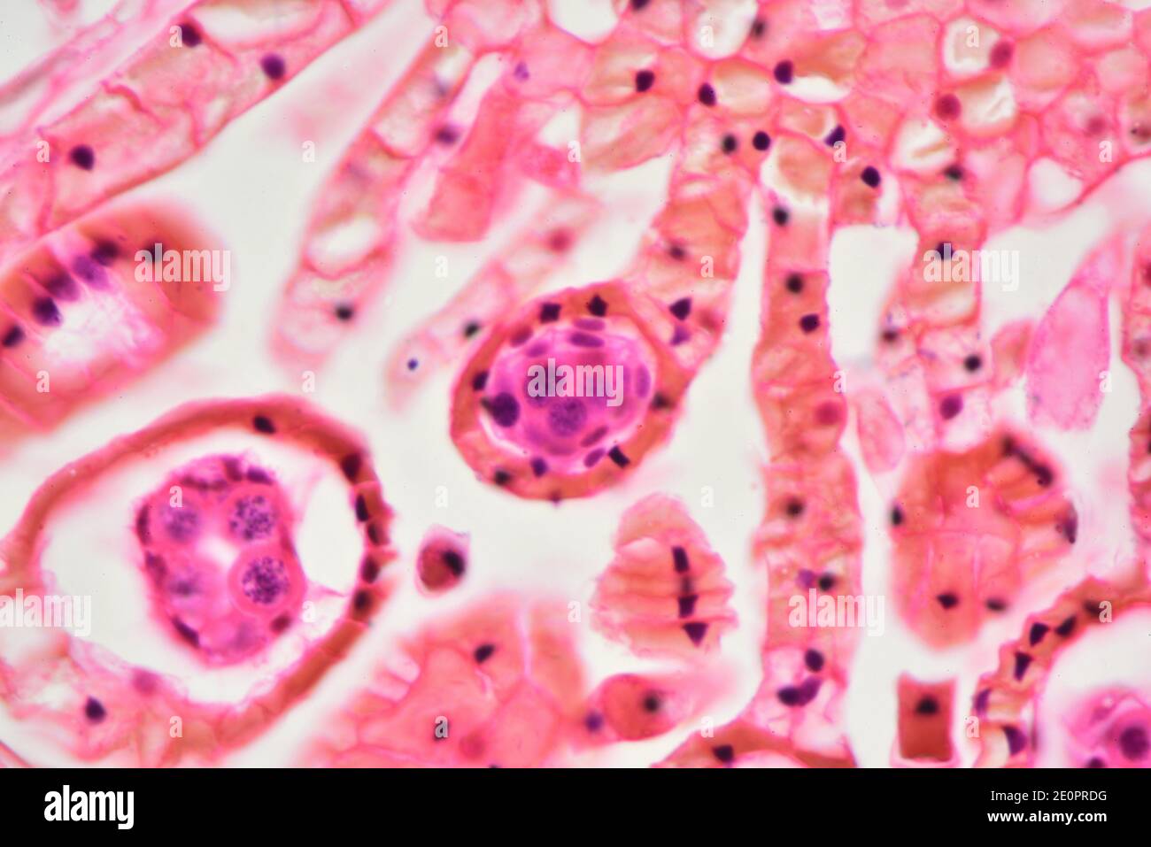 Fern Sori Under Microscope