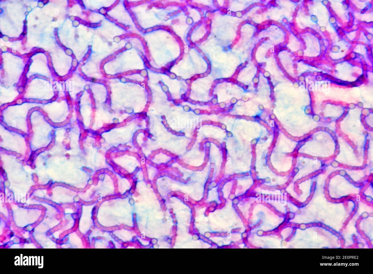 Cyanobacteria nostoc heterocysts hi-res stock photography and images ...