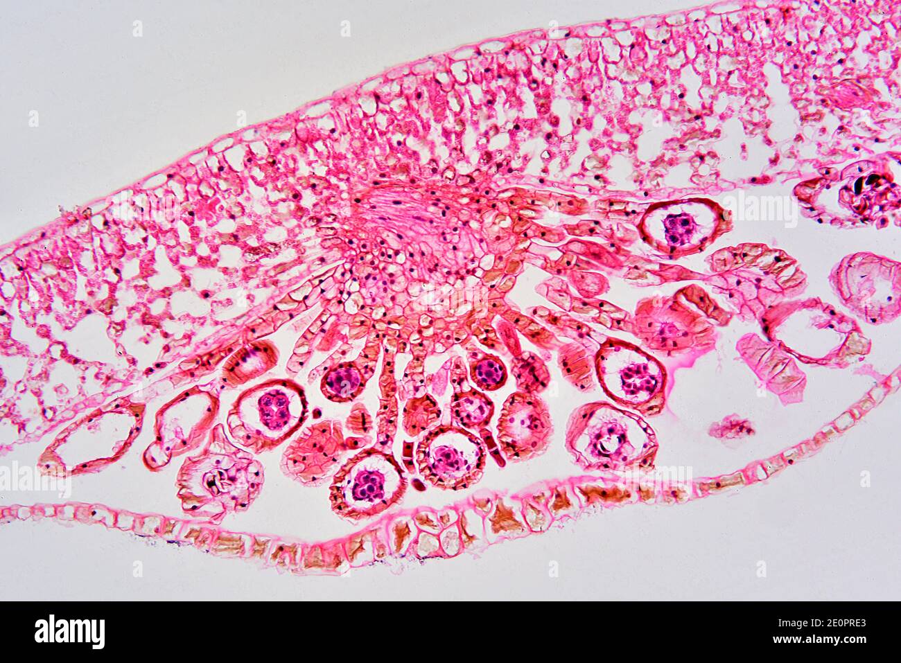 Fern Sori Microscope