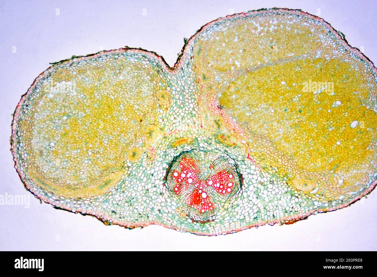Root nodules hi-res stock photography and images - Alamy