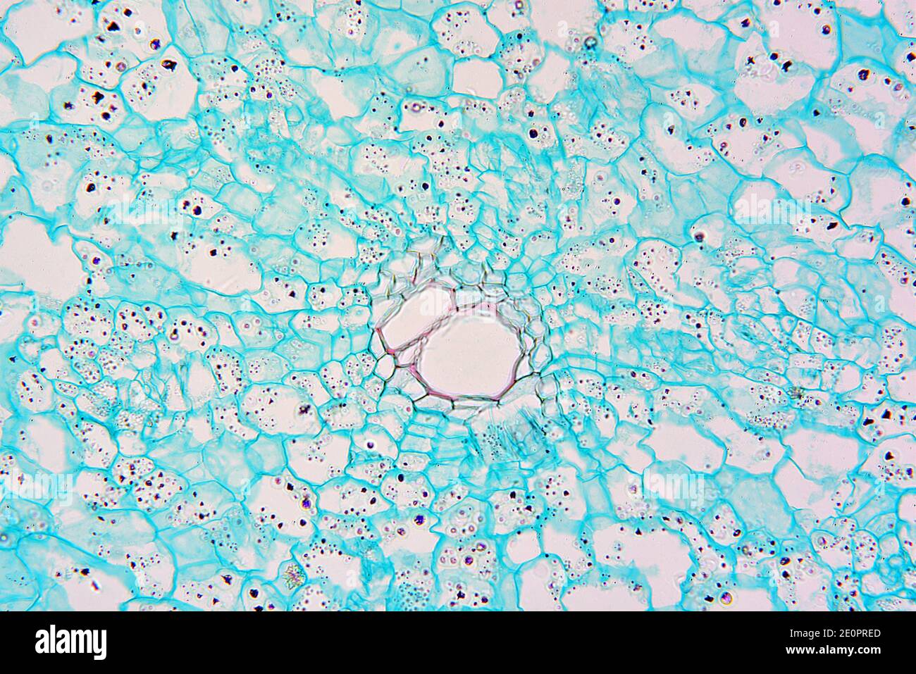 Amyloplast hi-res stock photography and images - Alamy