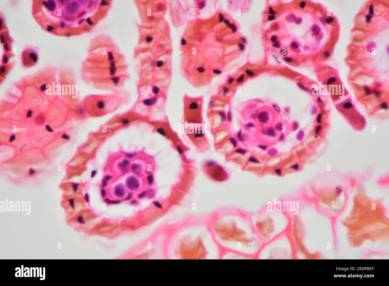 Fern sori sorus hi-res stock photography and images - Alamy