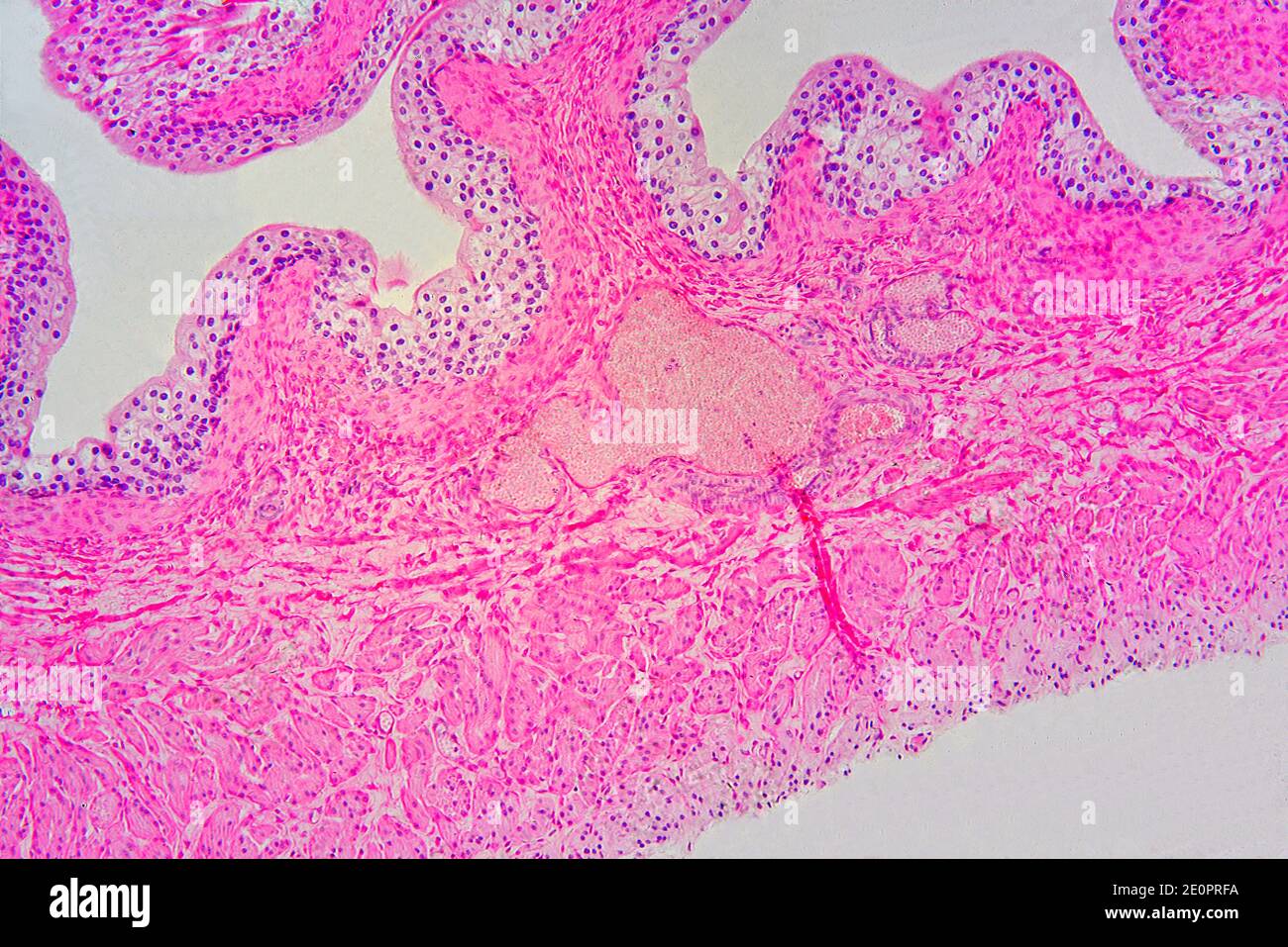 Transitional epithelium hi-res stock photography and images - Alamy