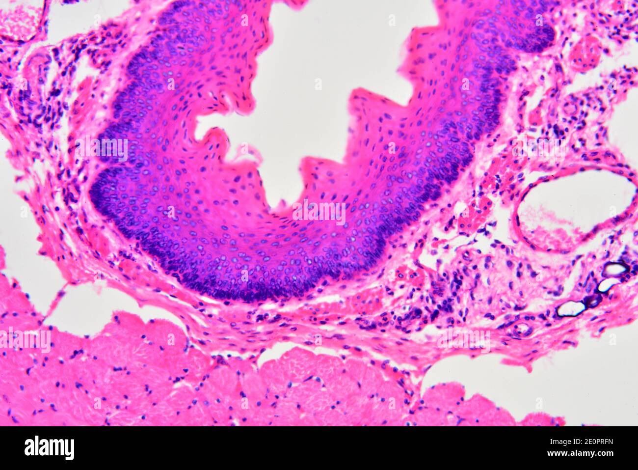 Stratified epithelium hi-res stock photography and images - Alamy