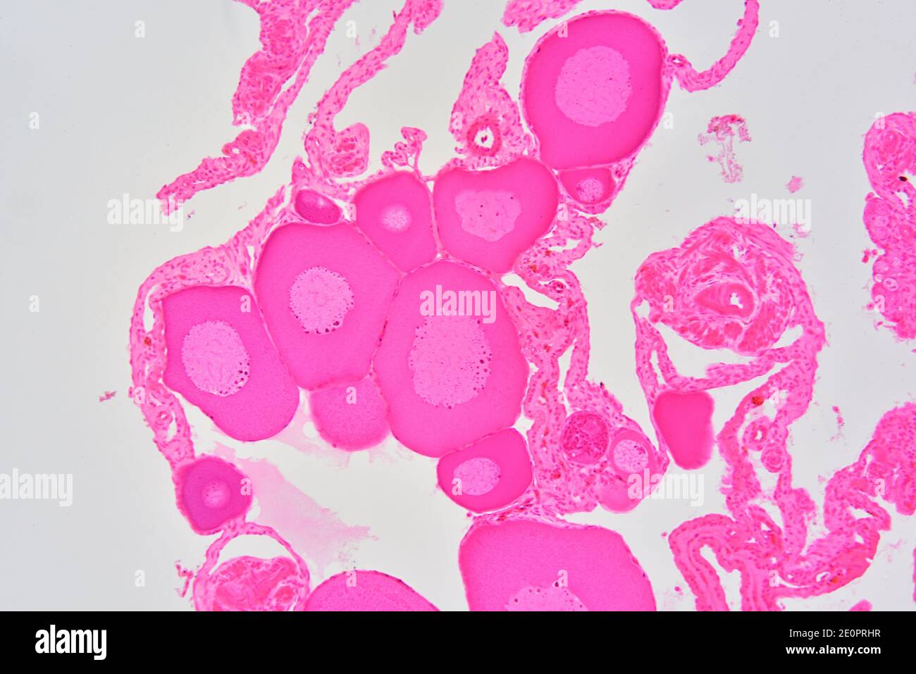 Germinal hi-res stock photography and images - Alamy