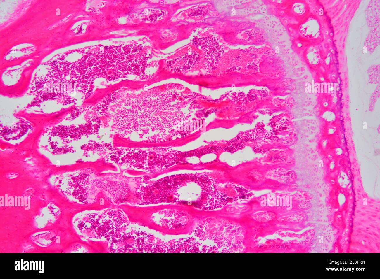 Médula ósea roja hi-res stock photography and images - Alamy