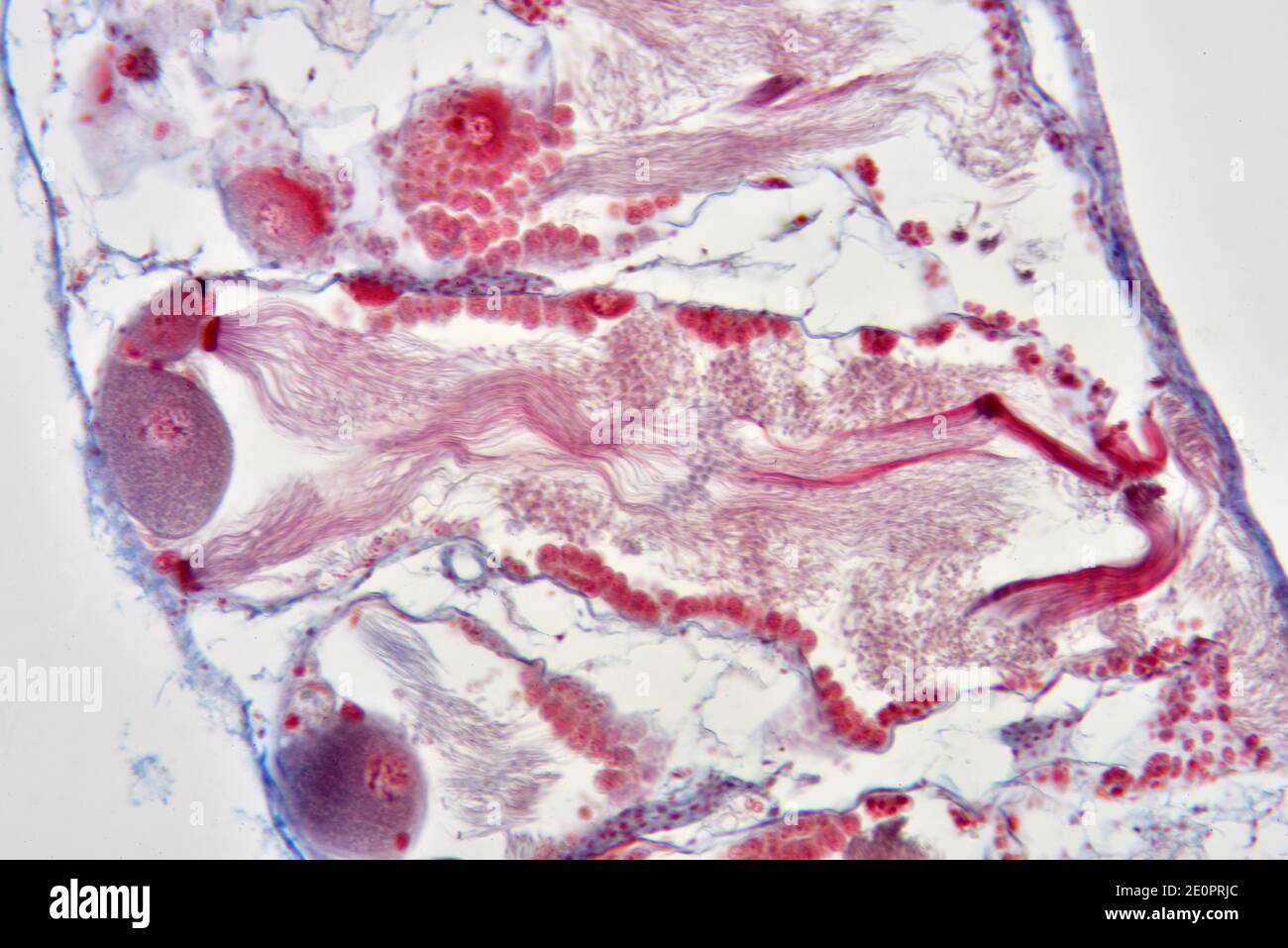 Ovotestis hi-res stock photography and images - Alamy