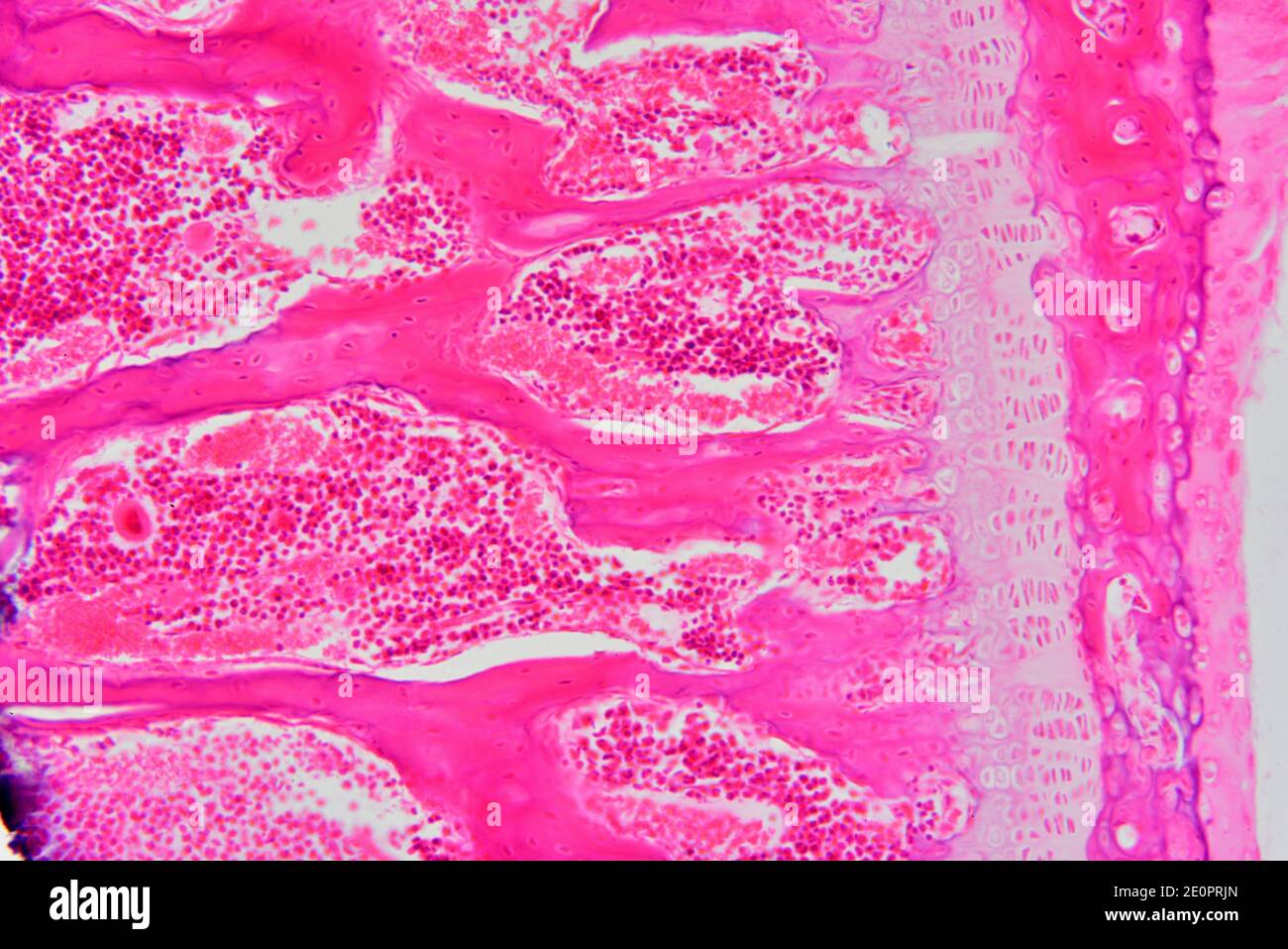 Histology bone marrow hi-res stock photography and images - Alamy