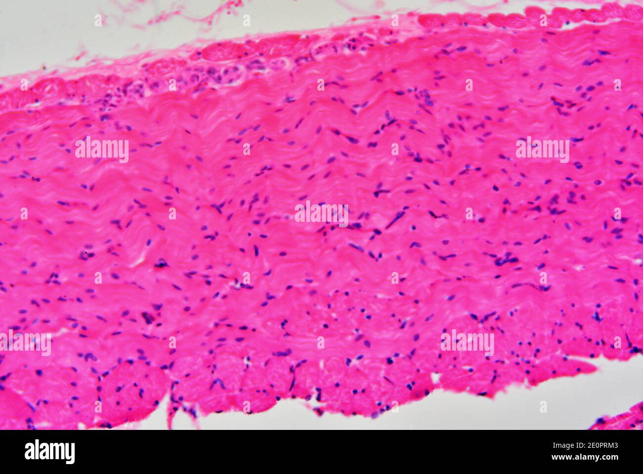 Smooth muscle microscope hi-res stock photography and images - Alamy