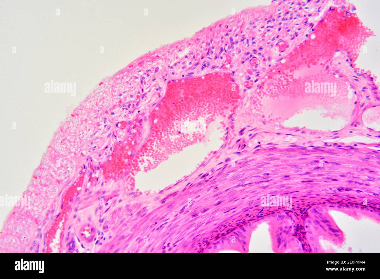 Blood Cells Muscle Fiber