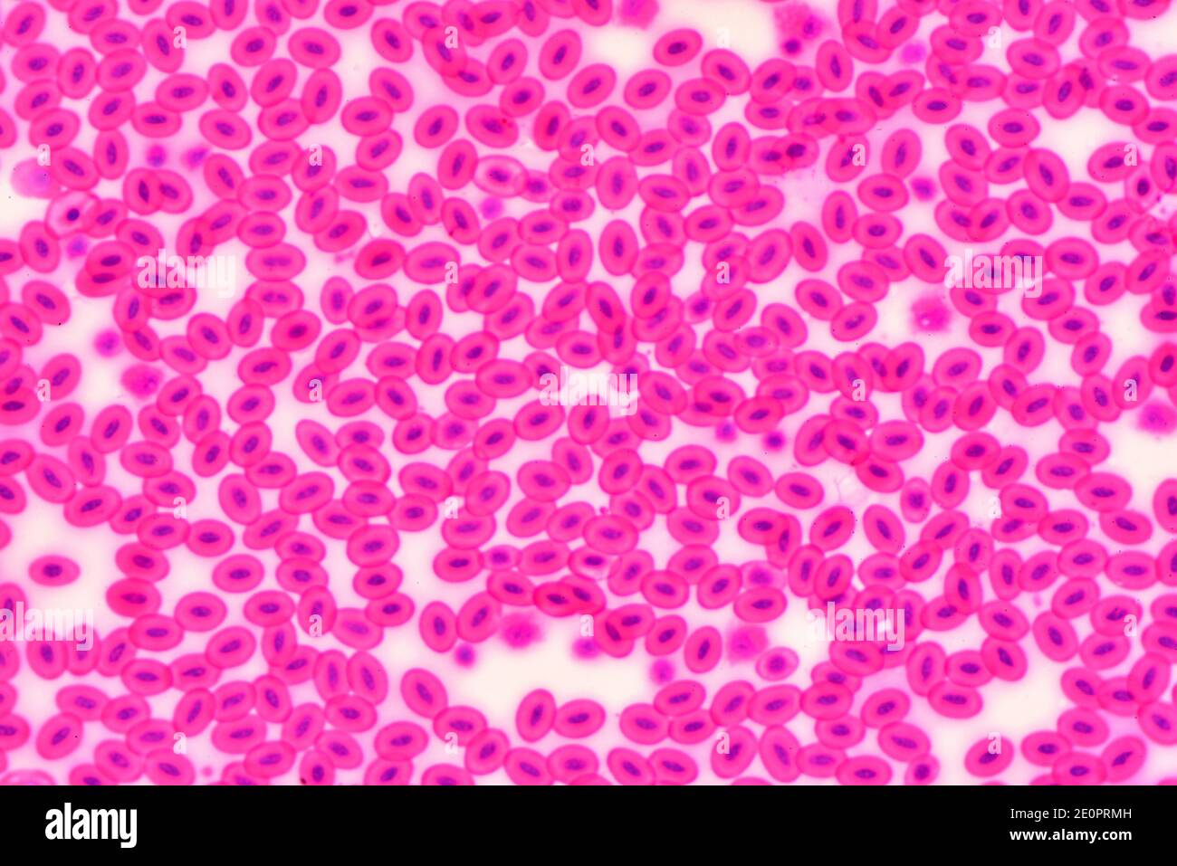 Hematology red blood cell hi-res stock photography and images - Alamy