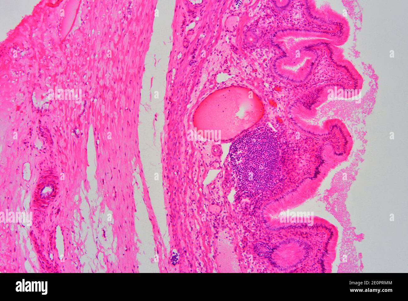 Smooth Muscle Fibers High Resolution Stock Photography and Images - Alamy