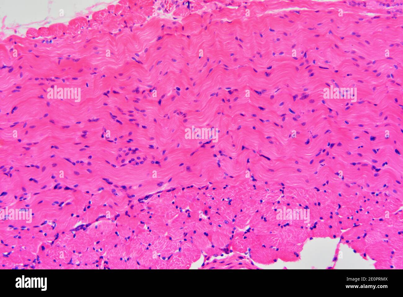 Smooth Muscle Cross Section