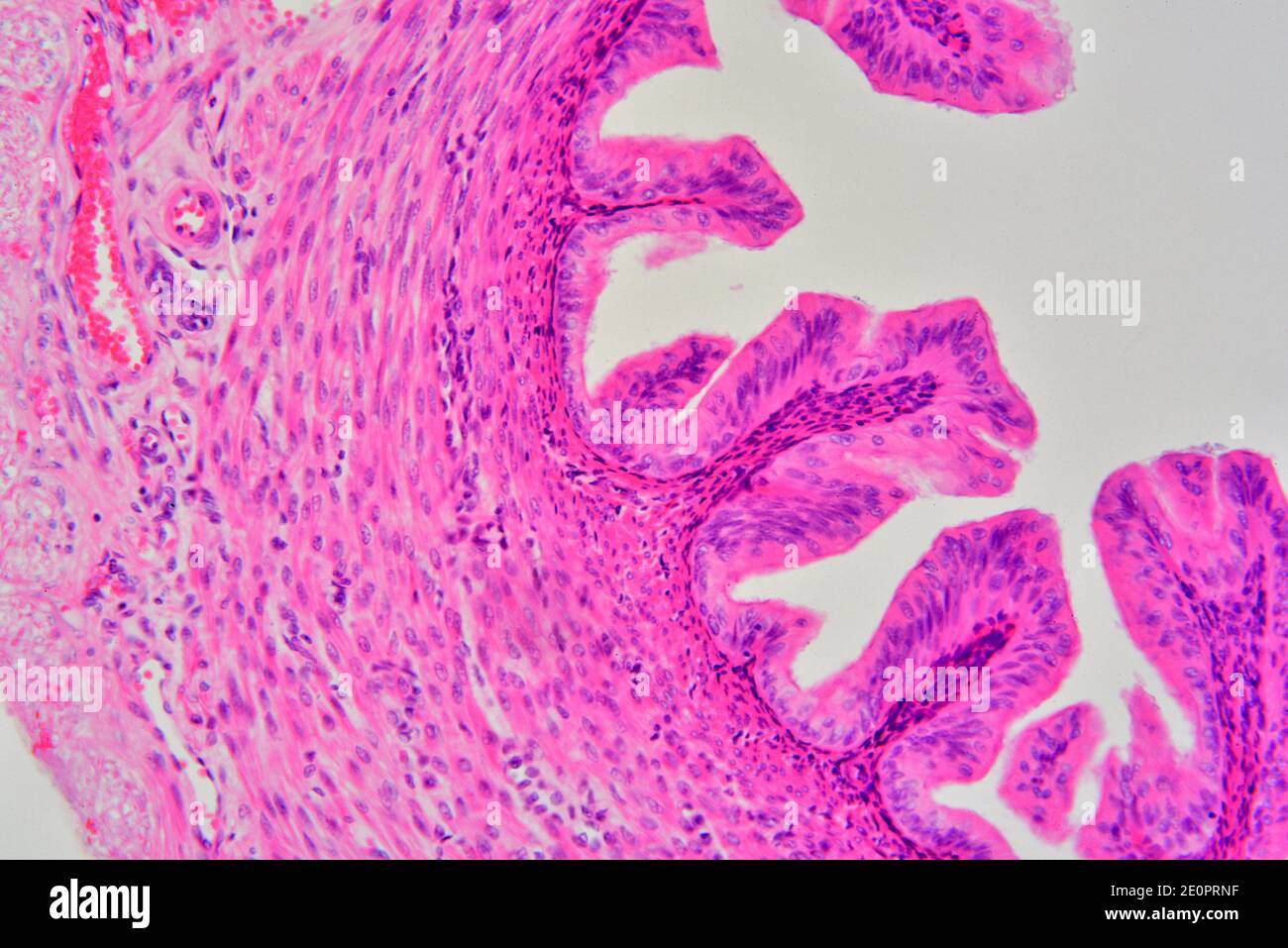 Uterine vessels hi-res stock photography and images - Alamy