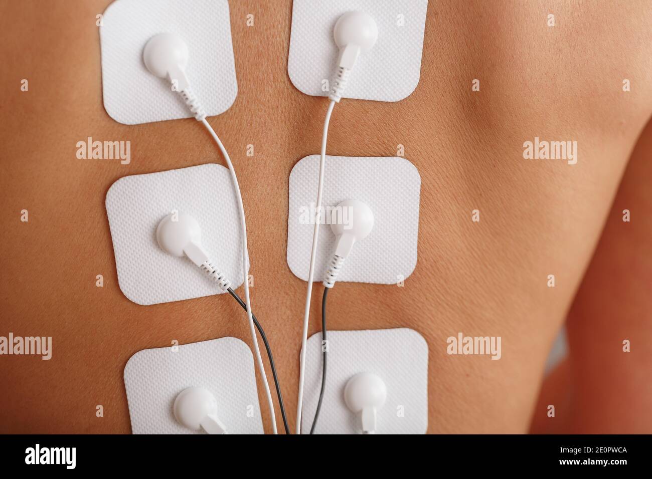 Back and shoulder massage with a muscle stimulator with attached ...