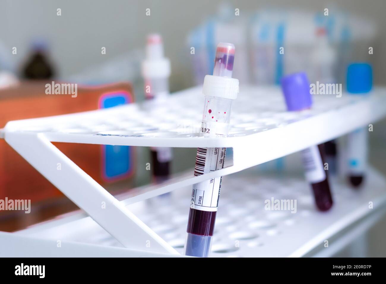 test tube with venous blood for analysis in a tripod in the treatment ...