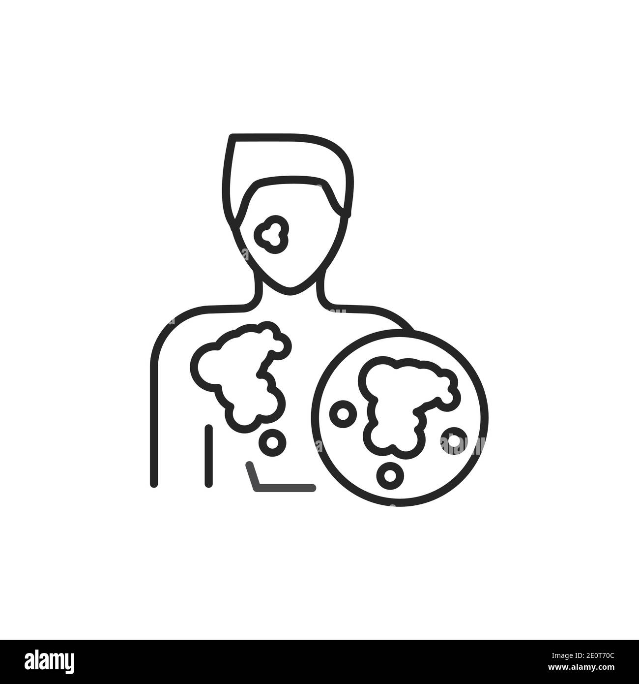 Atopic dermatitis line color icon. Sign for web page, mobile app ...