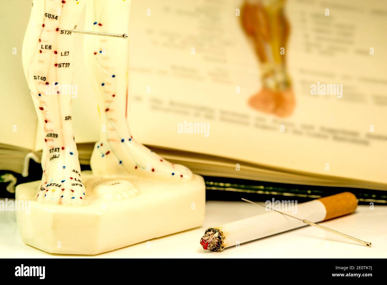 Acupuncture To Stop Smoking, Cigarette, Needle, Model And Textbook ...