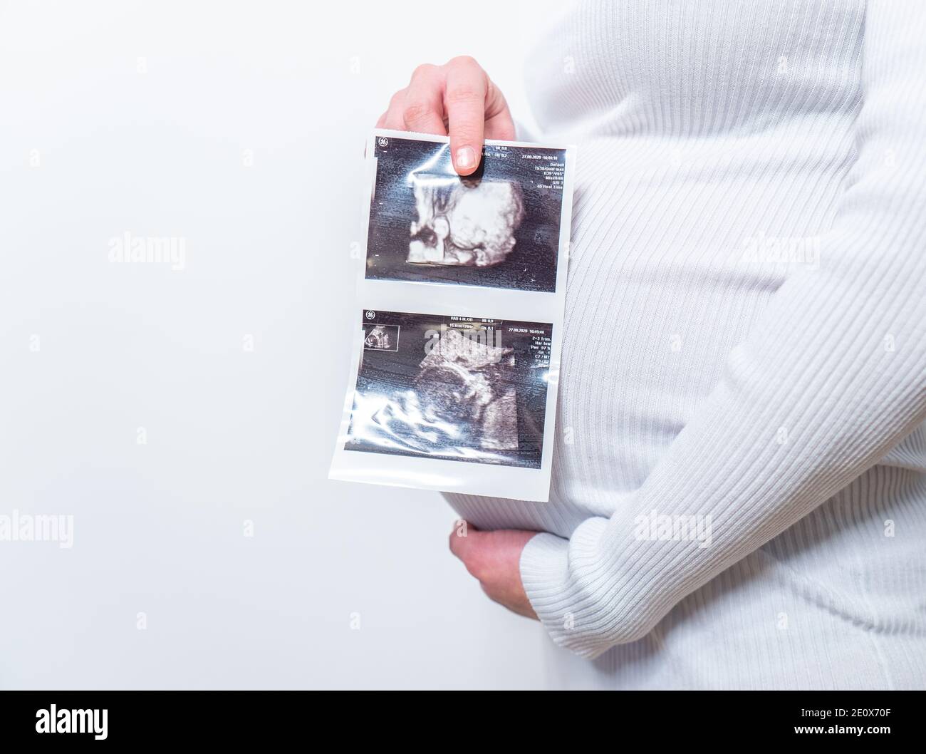 Big belly of pregnant woman holding the ultrasound film on her stomach ...