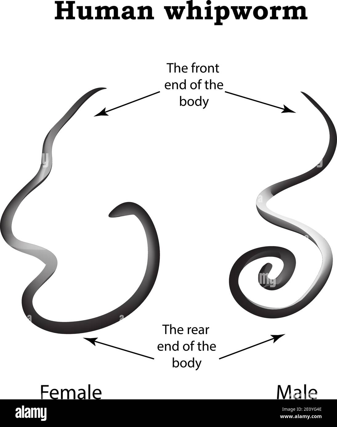 Trichuris Trichiura Labeled