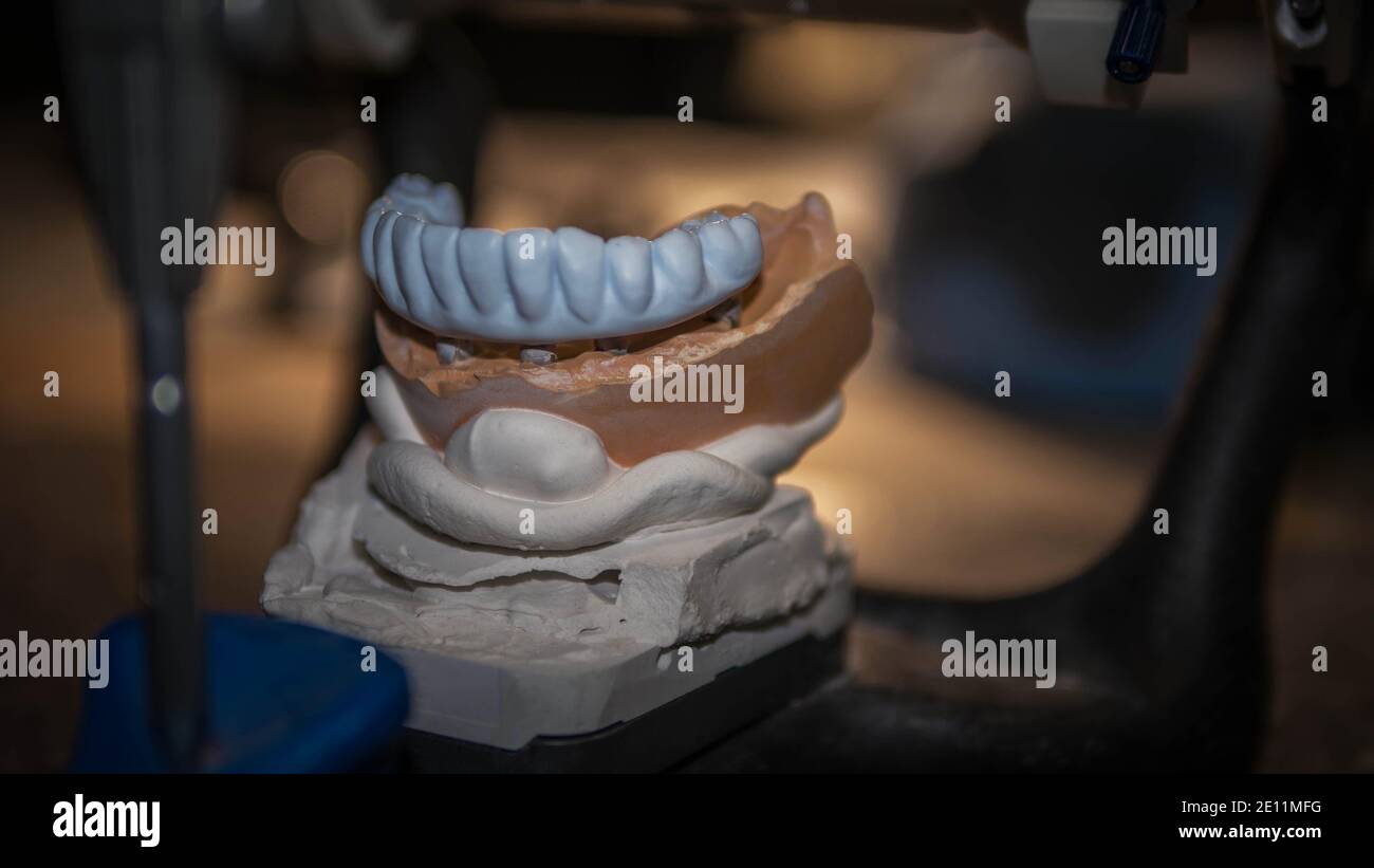Plaster model of teeth, the work of a dental technician, tools for ...